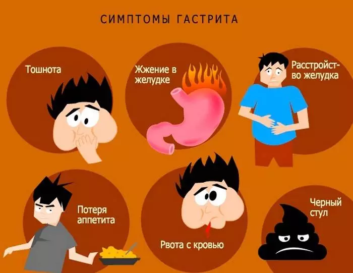 Simptomi gastritisa