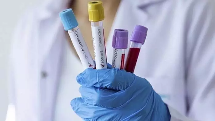 מה ההבדל בין בדיקת וירוס ובין בדיקת נוגדנים